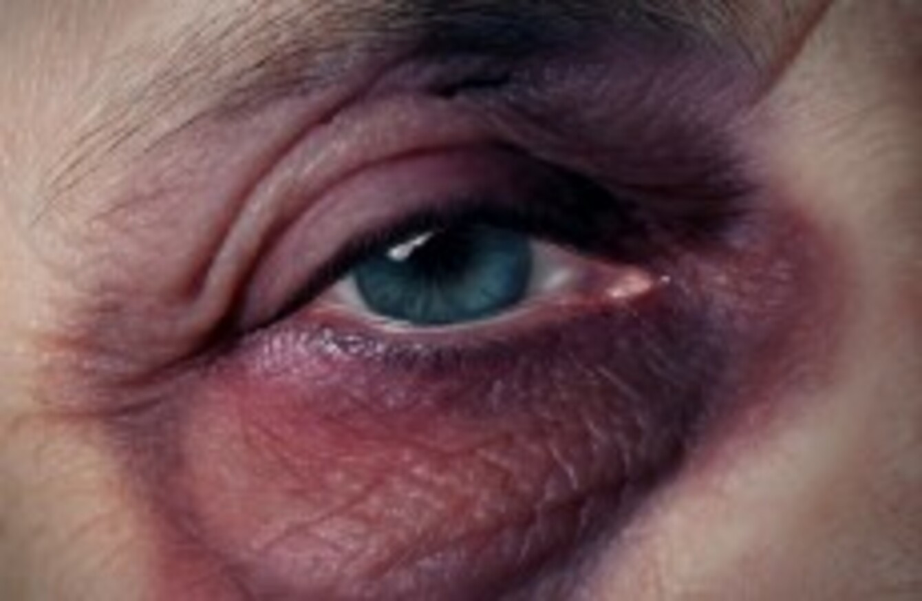 Most perpetrators of elder abuse are sons and daughters · TheJournal.ie