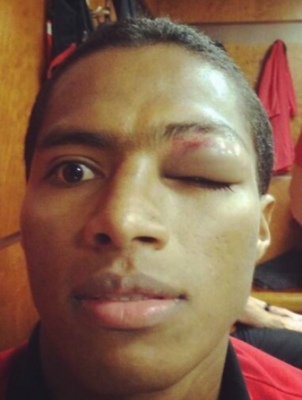 Antonio Valencia's selfie of his busted eye from last night's Champions ...