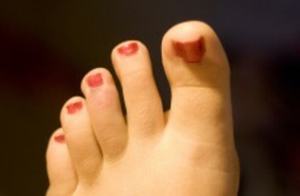 Toenail test lands Irish company €1.5million · TheJournal.ie