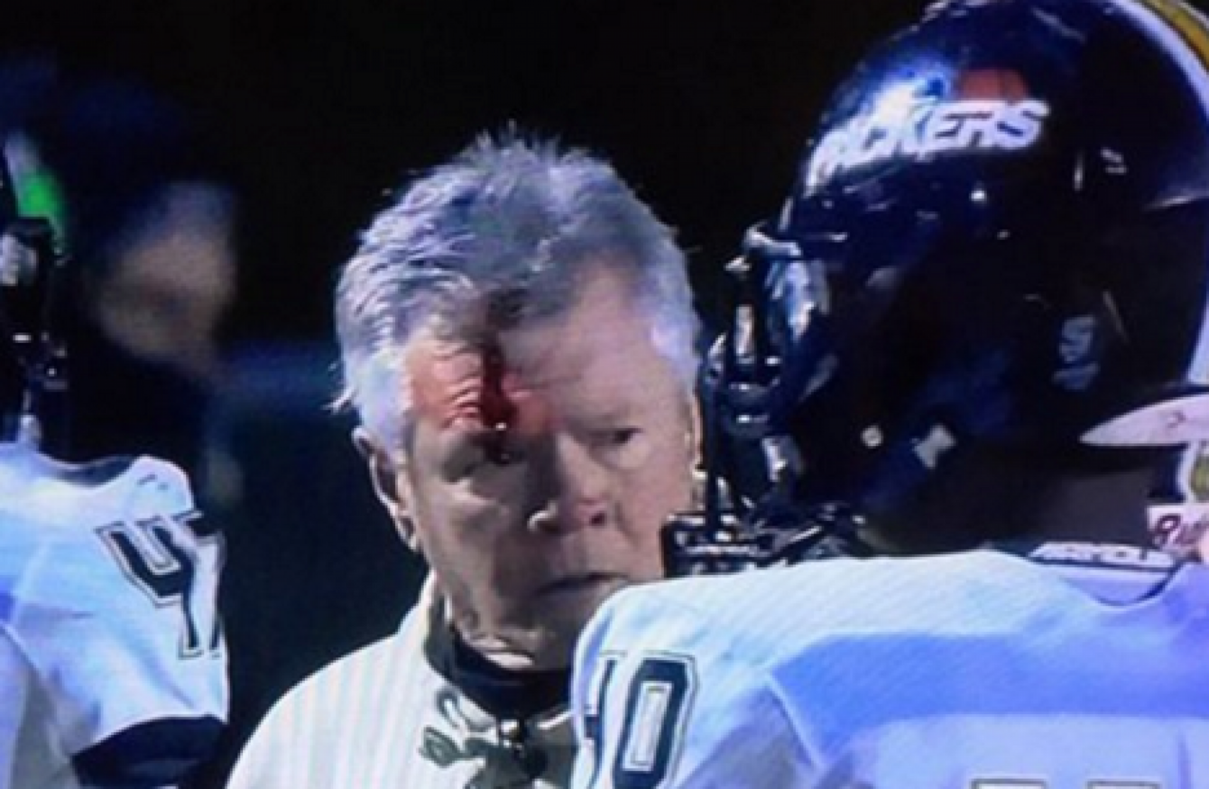 Definitive proof -- if it were needed -- that headbutting someone ...