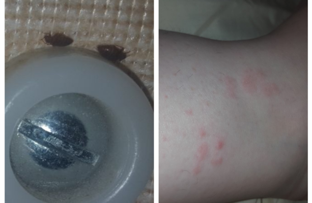 'It was filthy, absolutely filthy': Homeless family 'bitten by bed bugs ...