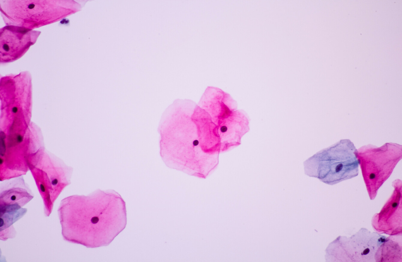 Women with history of abnormal smears face 'anxious wait' for delayed ...