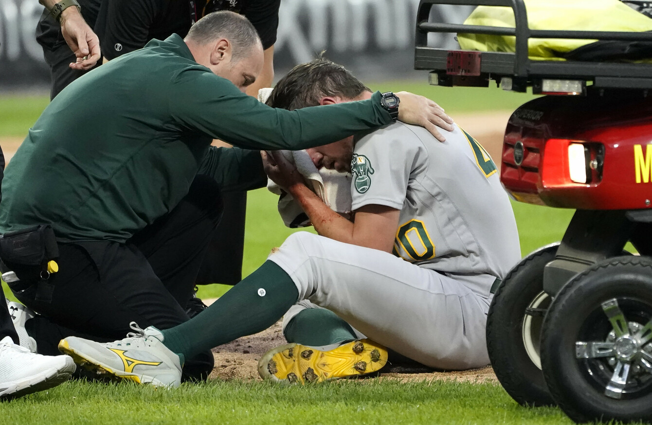 Baseball player hospitalised after being struck in the head with ball