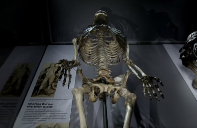 Skeleton of Irish 'giant' to be removed from display at London museum ...