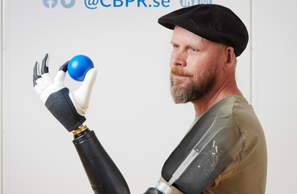 Man who lost his arm above the elbow moves individual fingers with ...