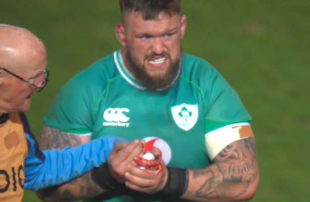 'My finger was half hanging off... I'd never seen the inside of my hand'