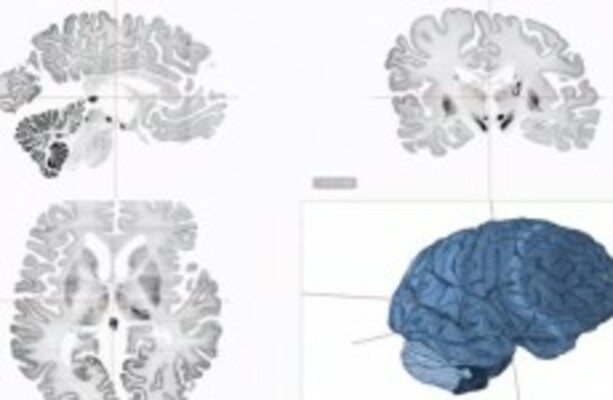 Scientists create most detailed map ever of human brain · TheJournal.ie