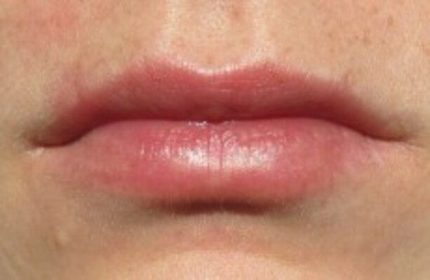 Woman accidentally superglues lips together · The Daily Edge