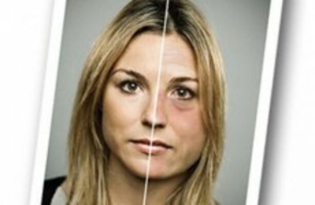 See what your alcohol intake could do to your face in 10 years
