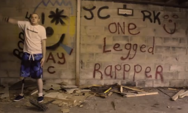 Meet the one-legged lad from Finglas who raps about having one leg