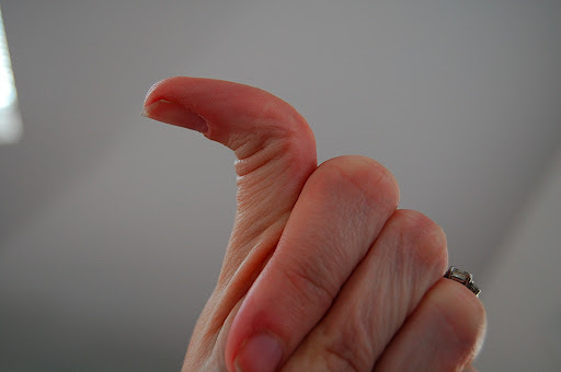 Everyone's sharing this 'weird' thumb holding an iPad, but it's ...