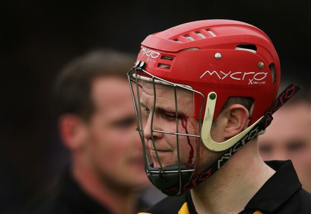 Allstars, shinty, All-Irelands, blood injuries, Cody and New York ...