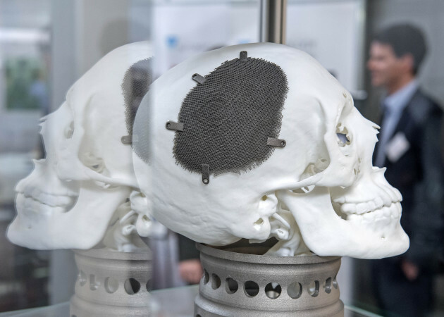3D-printed bone breakthrough made by Dublin researchers · TheJournal.ie