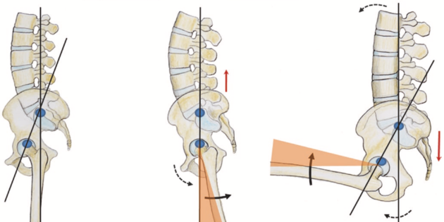 Consultant spine surgeon: Movement is key to avoiding back pain in the ...